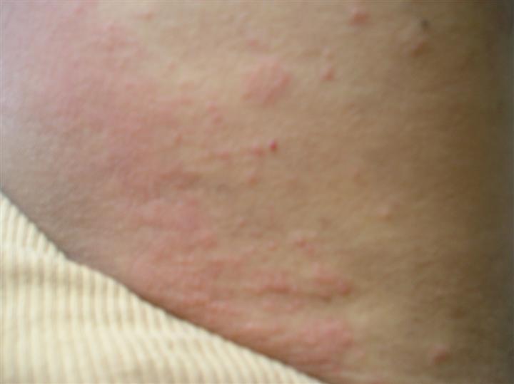 Stepping On the Grass